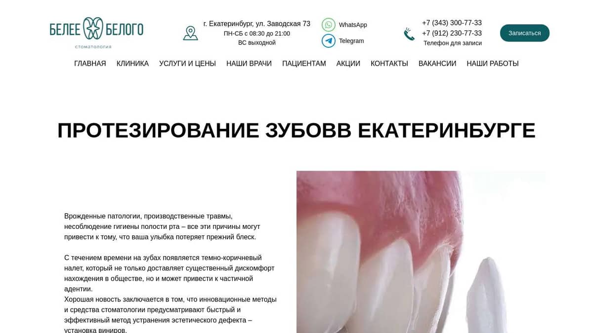 Виниры на зубы в Екатеринбурге | Белее Белого